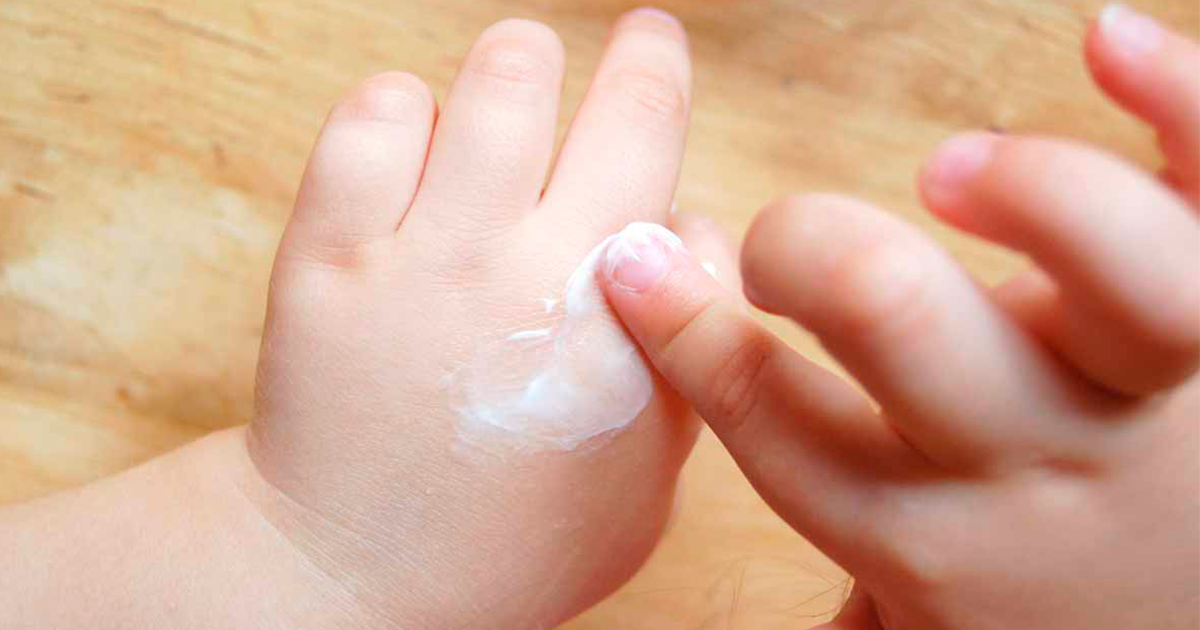 Evita las ronchitas rojas en tu bebé - 24 Morelos