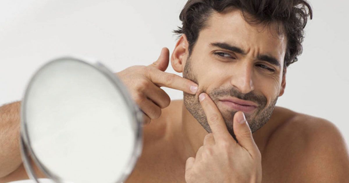 ¿Te exprimes los barritos? - 24 Morelos